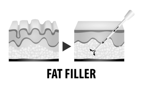 Facial Plastic Surgery in NYC New York